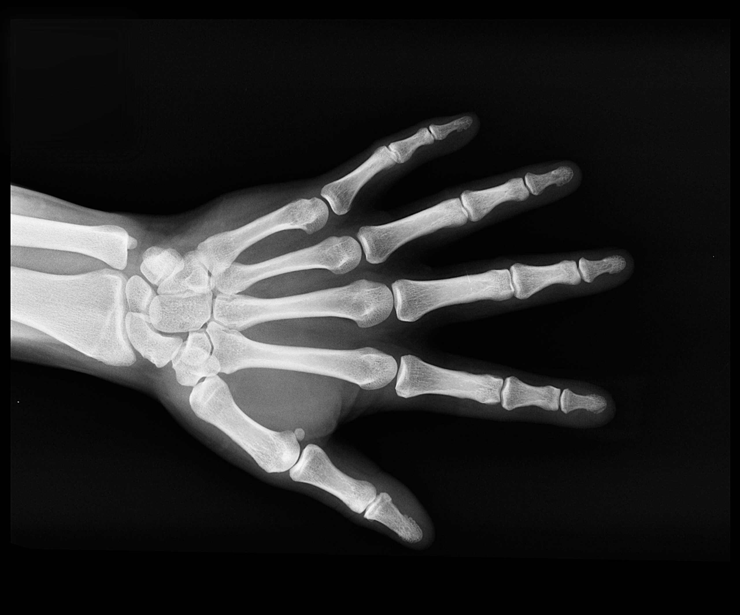 Musculoskeletal Imaging - Motion